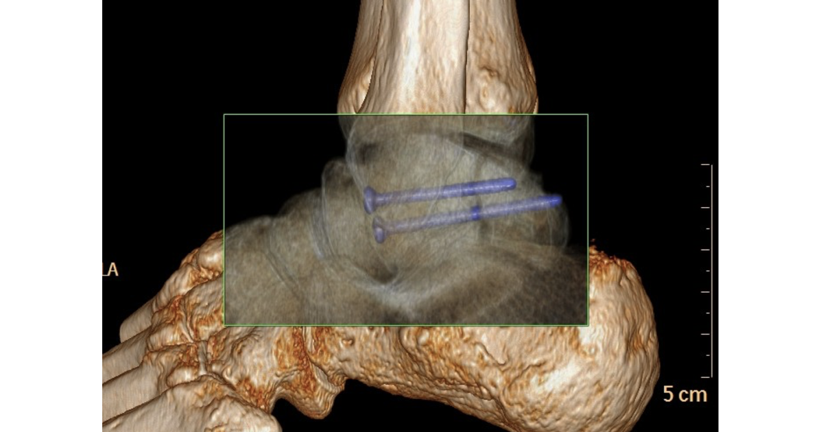 Musculoskeletal Imaging | Department of Radiology | The University of ...