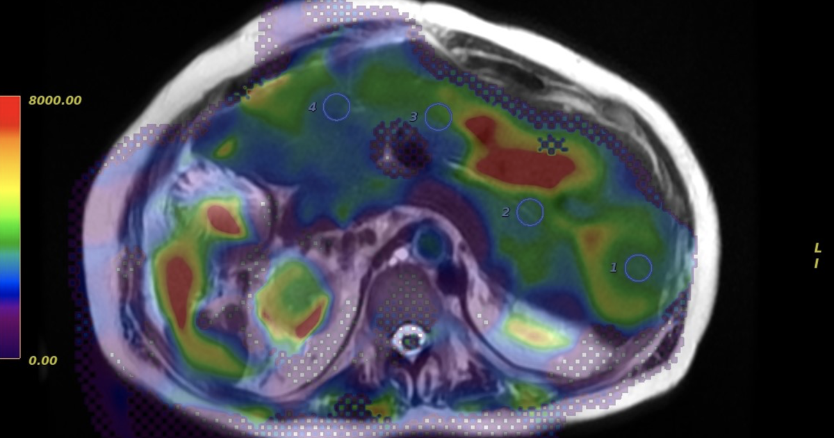 Abdominal Imaging | Department of Radiology | The University of Chicago
