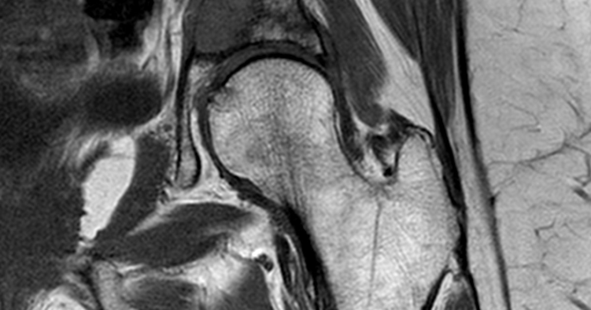 Musculoskeletal Imaging | Department of Radiology | The University of ...